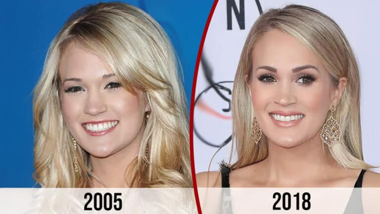 Why Carrie Underwood's Lips Look Different Now Than They Did Years Ago
